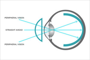 Myopia Control Consultations & Treatments | Modern Eyes Optometry